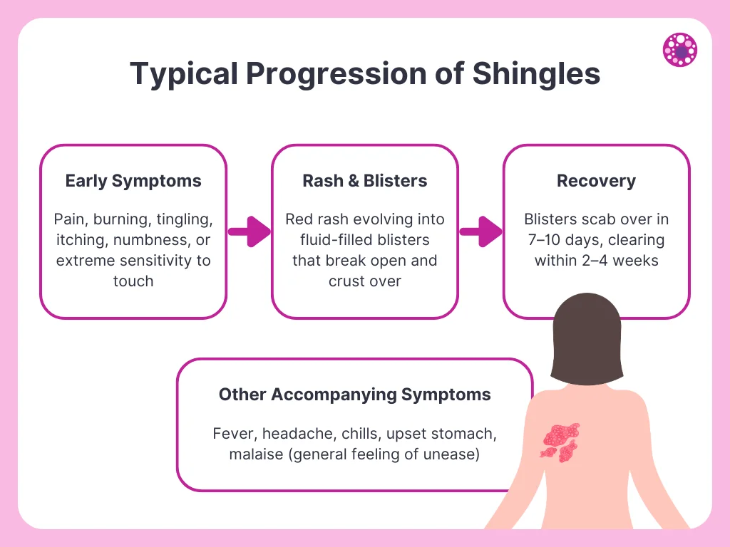 Shingles Symptoms And Treatment